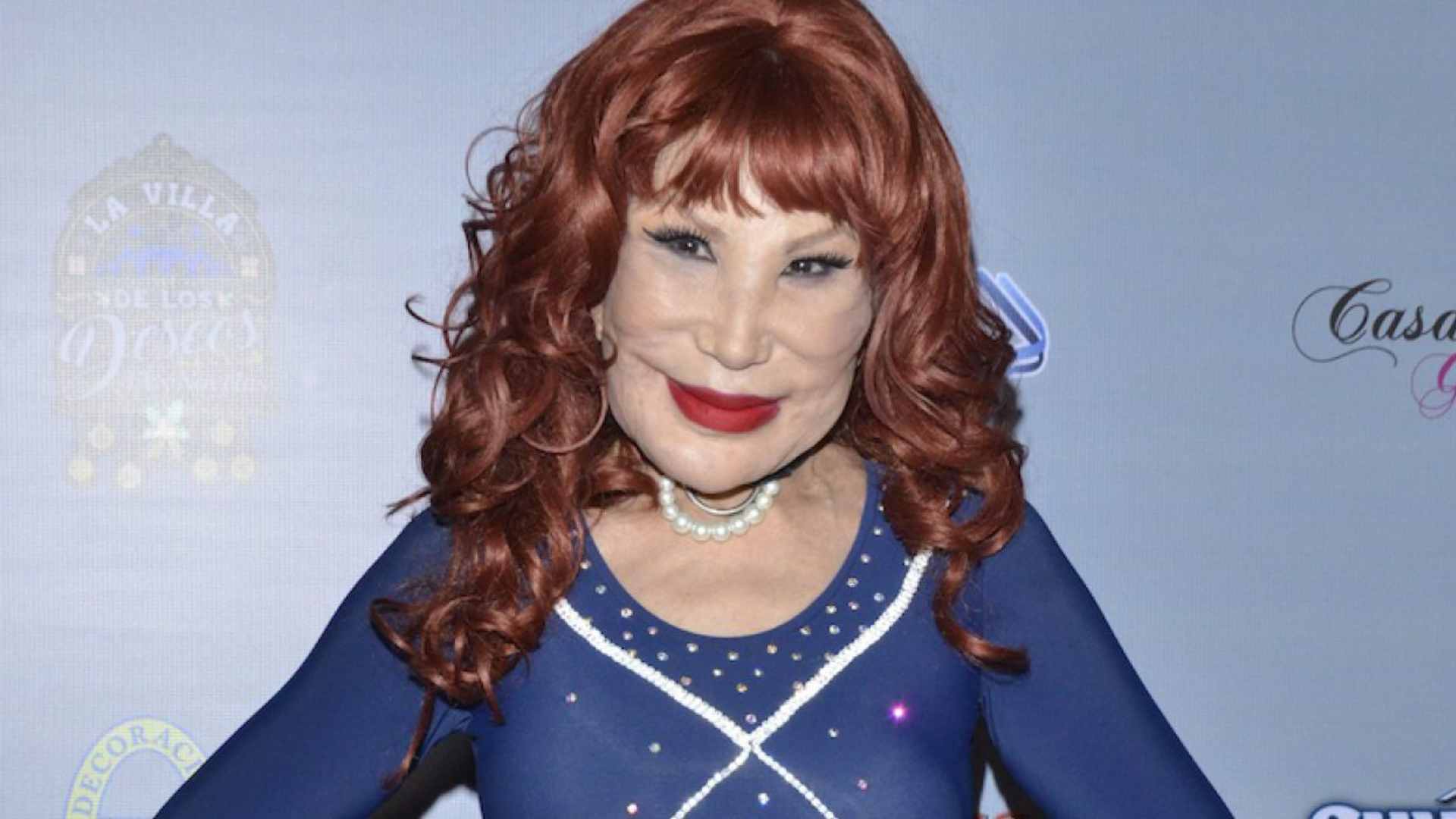 Lyn May se somete a enésima cirugía y muestra su nuevo rostro